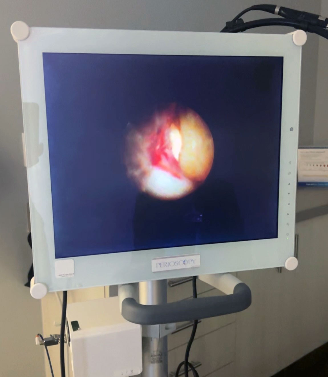 Perio Precise - Periodontal Endoscope Specialist’s in Las Vegas